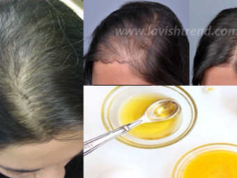 Solution miracle pour les cheveux fins et la perte de cheveux! Faites ...