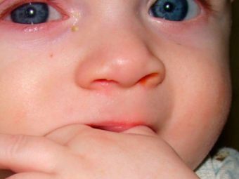 Attention !! Cette petite fille devient aveugle d’un œil ! La cause ...