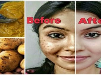 Il supprime les taches de votre visage en seulement 3 nuits! – Haus und Garten