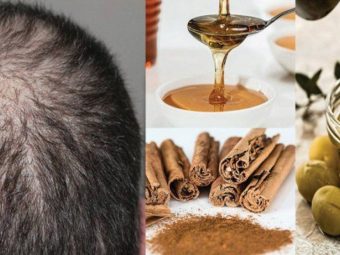 Voici comment stopper la chute des chutes des cheveux ! Cette méthode ...